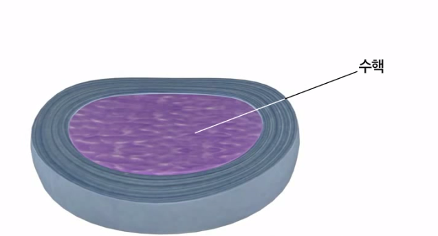 허리디스크 증상 및 원인과 운동 방법