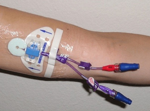 인터벤션 영상의학과 전문의가 알려주는 PICC 시술의 모든 것