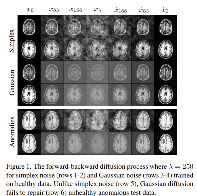 AnoDDPM 논문 리뷰 (AnoDDPM: Anomaly Detection with Denoising Diffusion ...