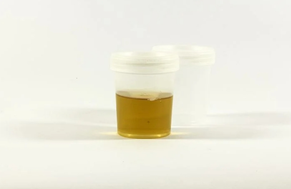 요로법을 실천하면서 궁금한 점들 (4주차)