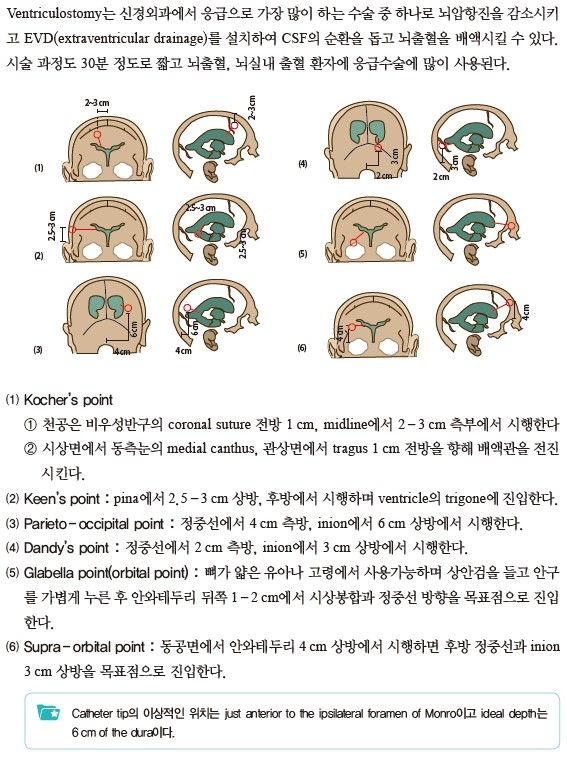 EVD : 네이버 블로그