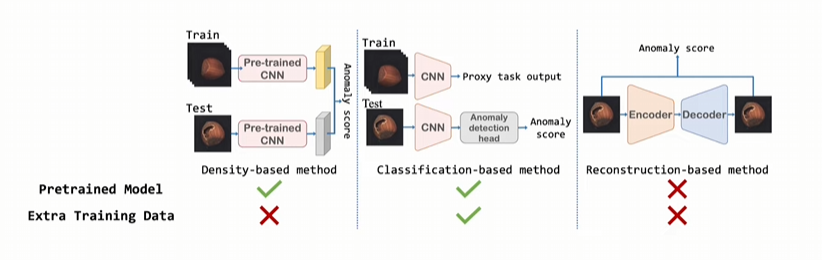 [Paper Review](PatchCore) Towards Total Recall in Industrial Anomaly ...