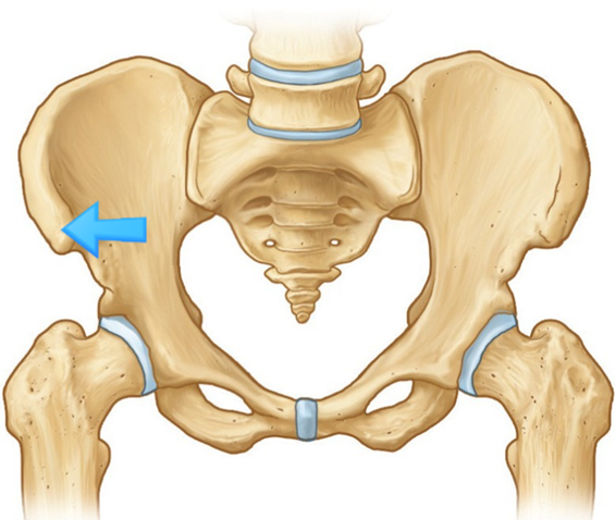 패트릭 검사(Patrick Test) = Faber test / 검사방법, 검사결과, 사진 : 네이버 블로그