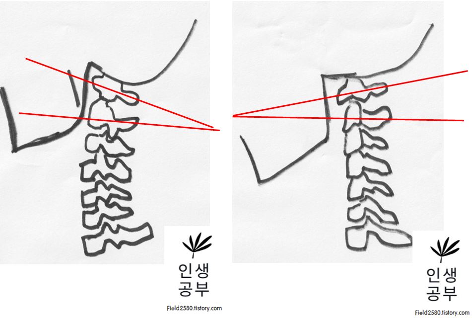 목 X-RAY 보는 방법(How to Read a Cervical X-ray) - 선 긋는 방법 : 목뼈(CERVIAL ...