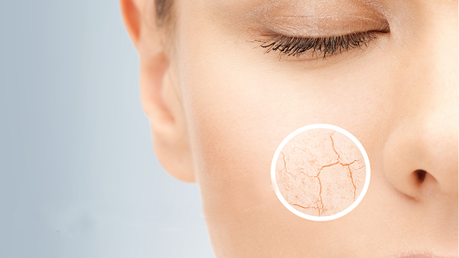 Recommendation for Winter Skincare Moisturizer