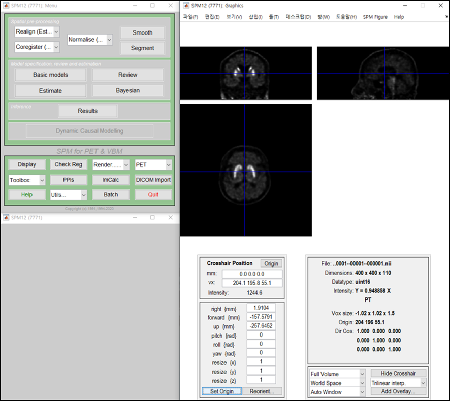 [MATLAB / SPM12] 의료영상 공간 정규화 (T1 template)