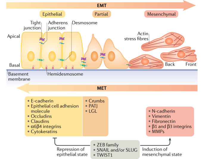 Biology) Epithelial-Mesenchymal Transition (EMT) 정리 & Cancer