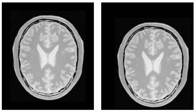 [SimpleITK] Python으로 medical image processing하기 - (2) Registration 1