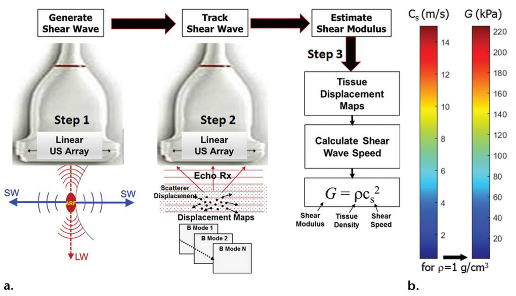 Ultrasound shear wave elastography (SWE) 간섬유화를 간편하게 측정하는 방법