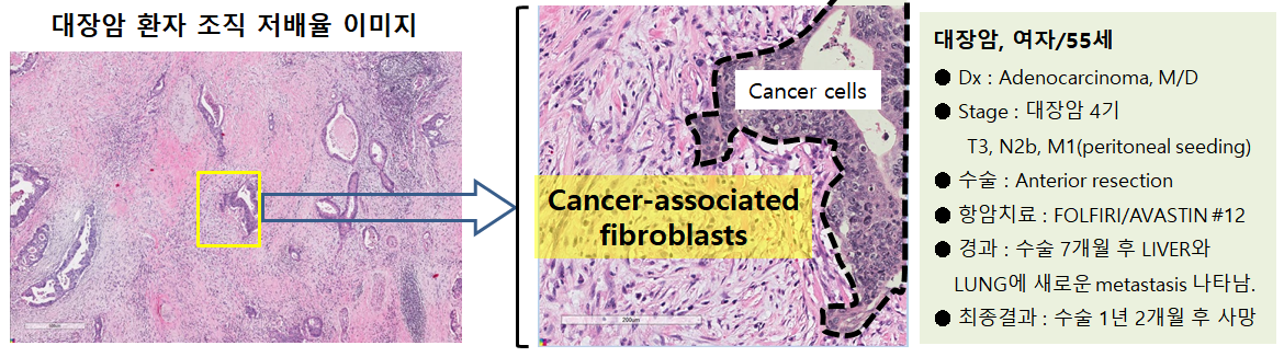 새로운 anti-CAF drug의 발굴과 전임상 검증