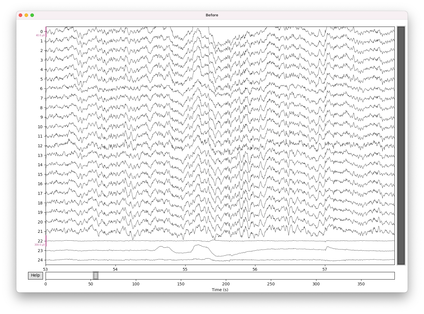 [MNE-Python] 선형회귀를 이용하여 EEG 신호에서 안구 운동 제거