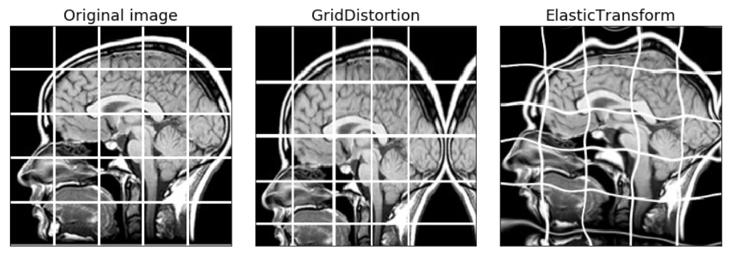 Albumentations 이미지 Augmentation API 소개