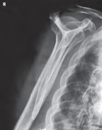 싱글벙글 잡학지식