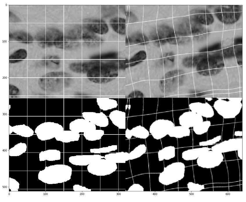 논문리뷰 U Net Convolutional Networks For Biomedical Image Segmentation 2015