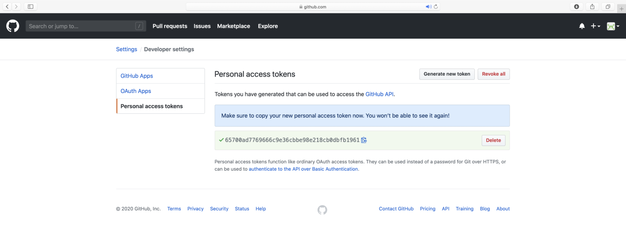 [VS Code Extensions] Setting Sync 사용법