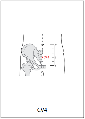 임맥 (CV) > CV4 관원 (關元) - 오케파파(OKePaPa)의 세상