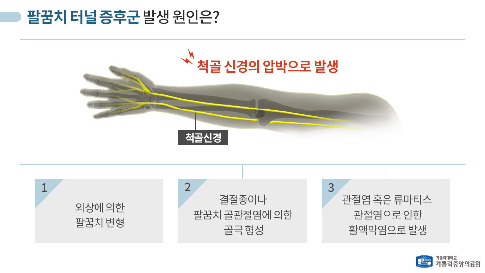 엎드려 자면 어떻게 될까 허리 디스크 있을 때 눕는 자세 만세하는 자세 올바른 수면 자세