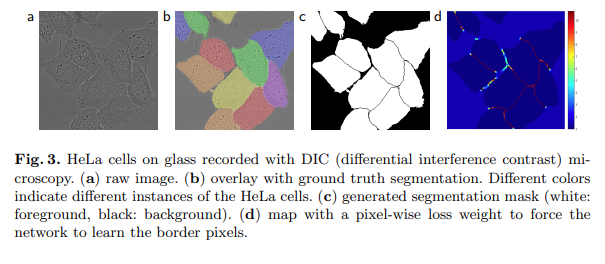 U-Net: Convolutional Networks for Biomedical Image Segmentation — craft ...