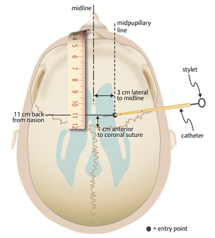 EVD : 네이버 블로그