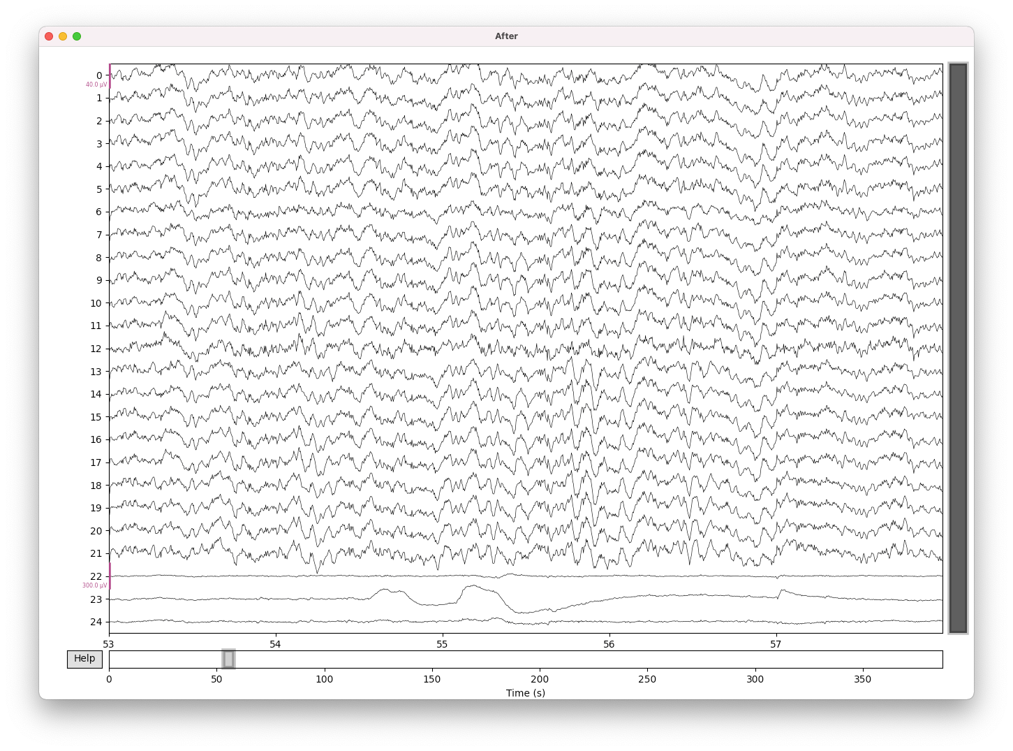 [MNE-Python] 선형회귀를 이용하여 EEG 신호에서 안구 운동 제거