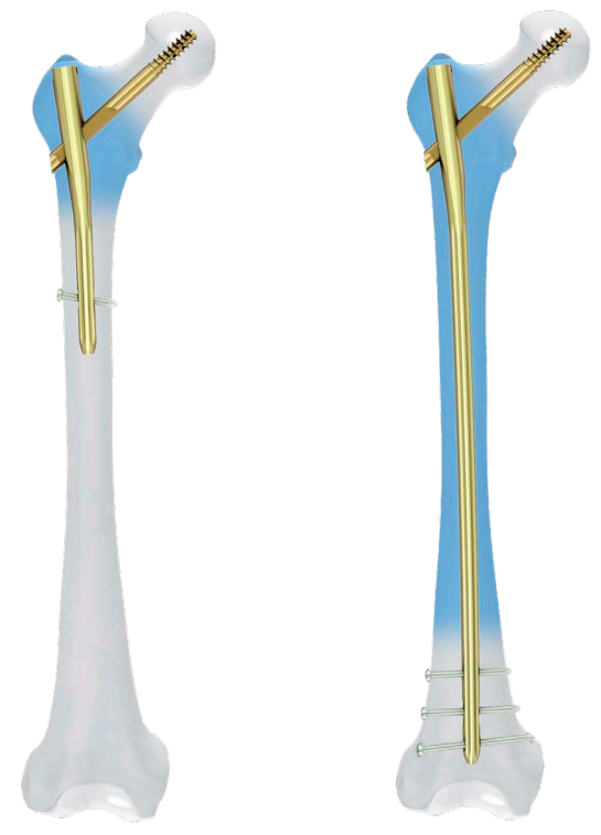 [OS 공부] 병동 의학용어 모음