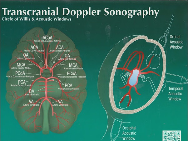 TCD 뇌혈류초음파 뇌혈류구조 판독의 이해 기본정리2