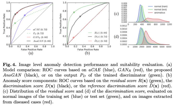 AnoGAN - Anomaly Detection 논문 리뷰